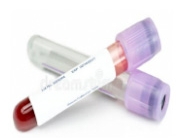ZCD Virus disease – SolGent Co., Ltd